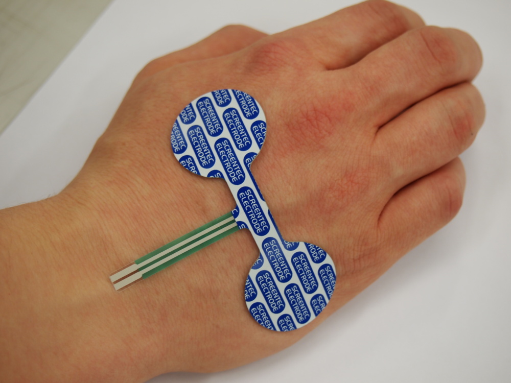 Hydrogel Dispensation in Disposable Medical Electrodes: Enhancing ...